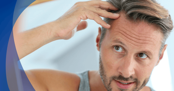 How Often Should You Remove Your Hair System? A Comprehensive Guide